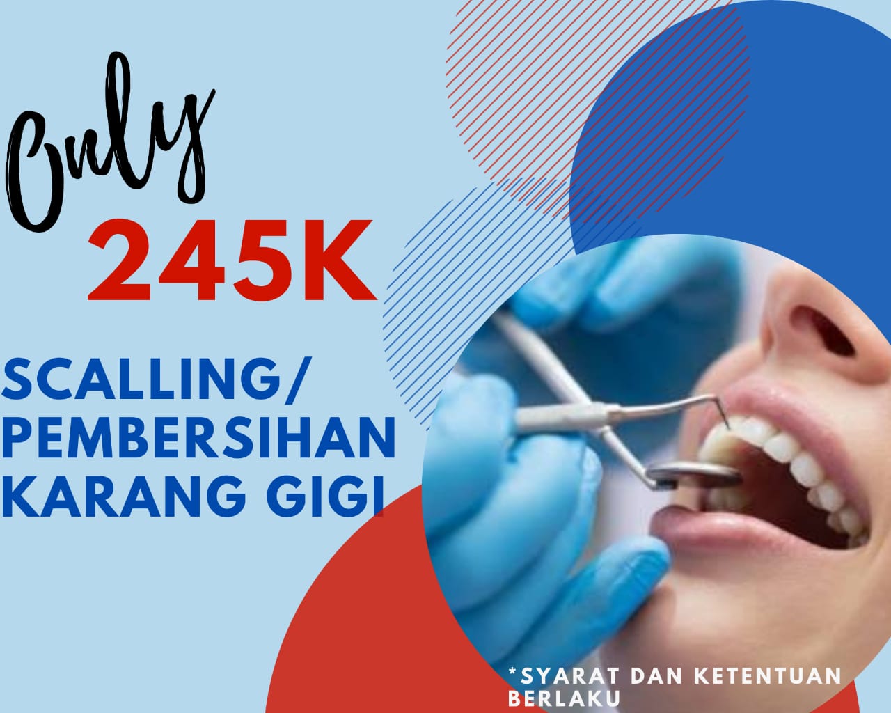 Odontektomi / Operasi gigi bungsu - Klinik Gigi di Bekasi | Klinik Gigi ...
